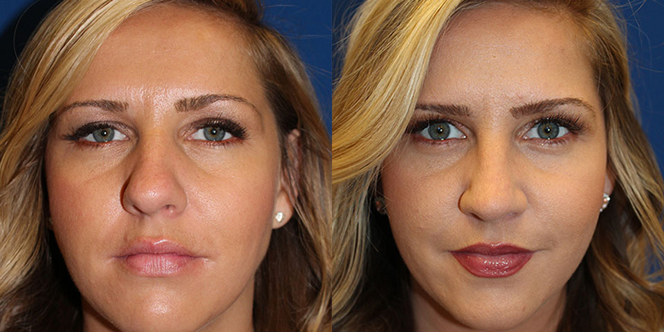 Real Patient Case: 4604 | Andrew Compton, MD | Troy, MI