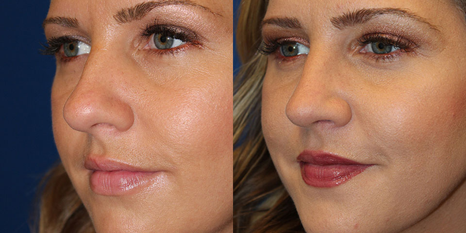 Real Patient Case: 4604 | Andrew Compton, MD | Troy, MI